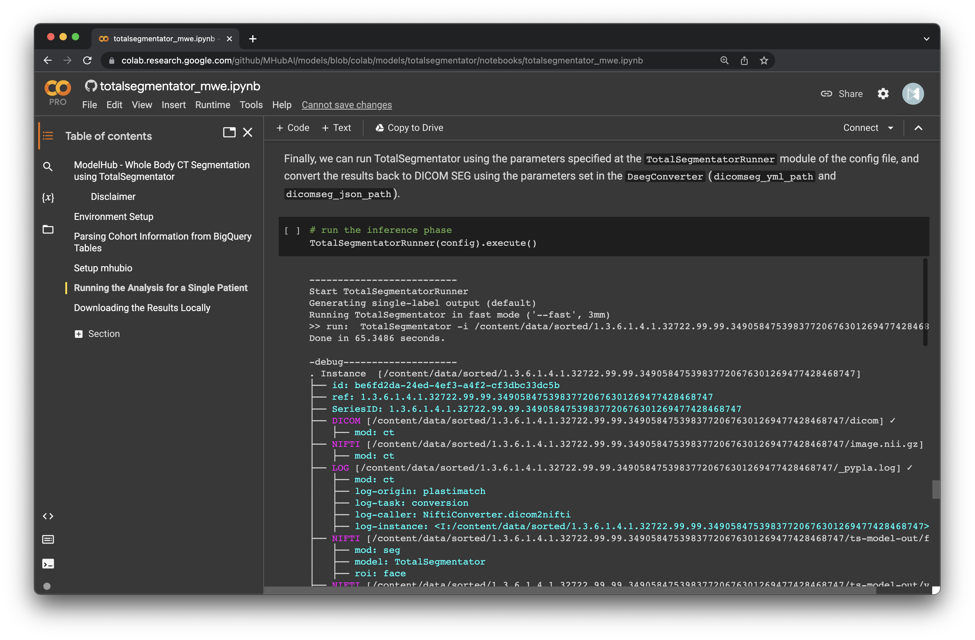 MHub - The New Deployment Standard for Medical Imaging AI